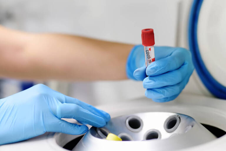 Ana ed Ena, cosa sono e cosa determinano i loro valori